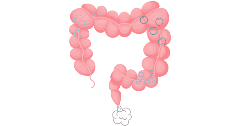 Bloating – why do I feel my belly is like a balloon and what can I do ...